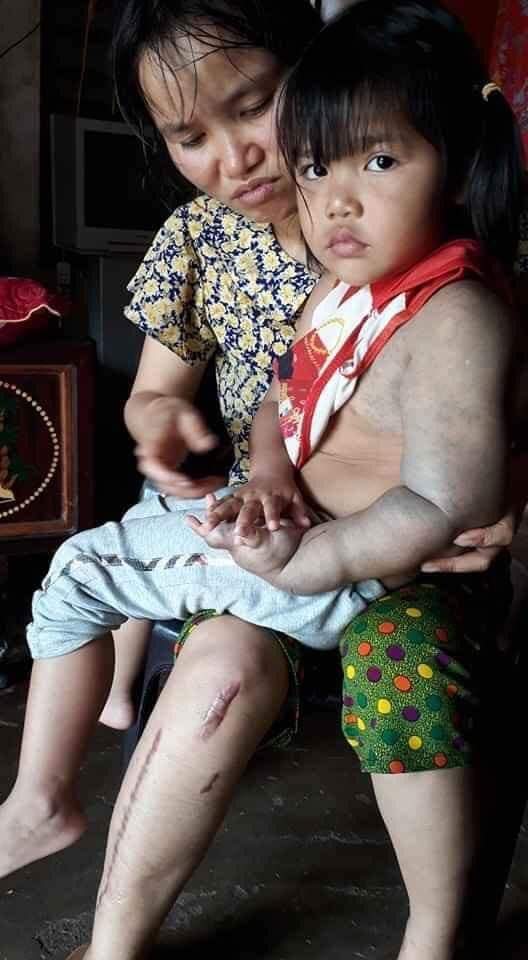 The Children of Vietnam Charitable Fund